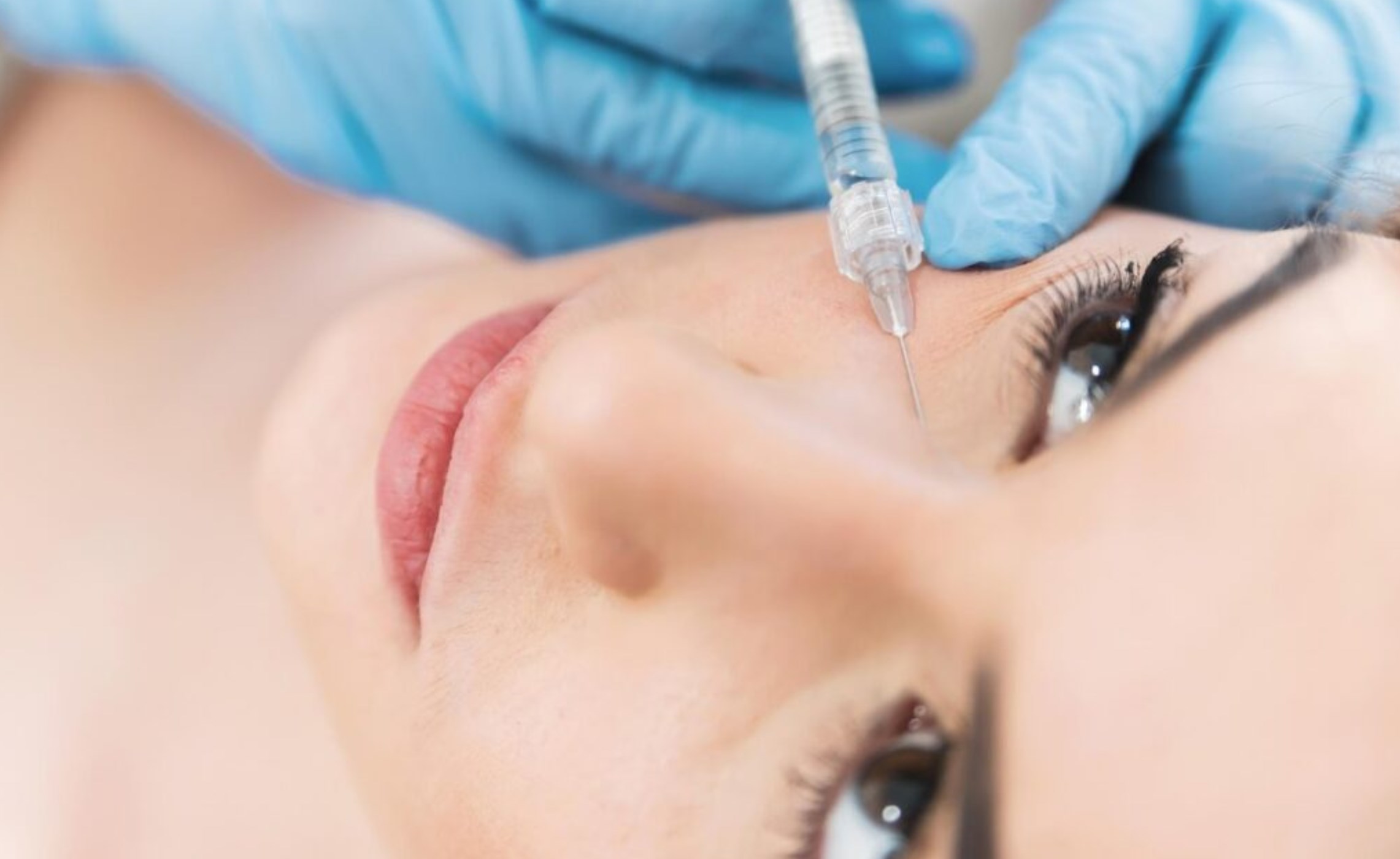 Under Eye Hollows Explained – Causes, Aging Patterns, And Treatment ...